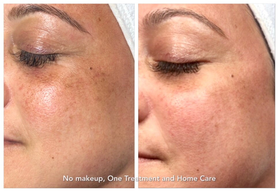Skin Care Transformations