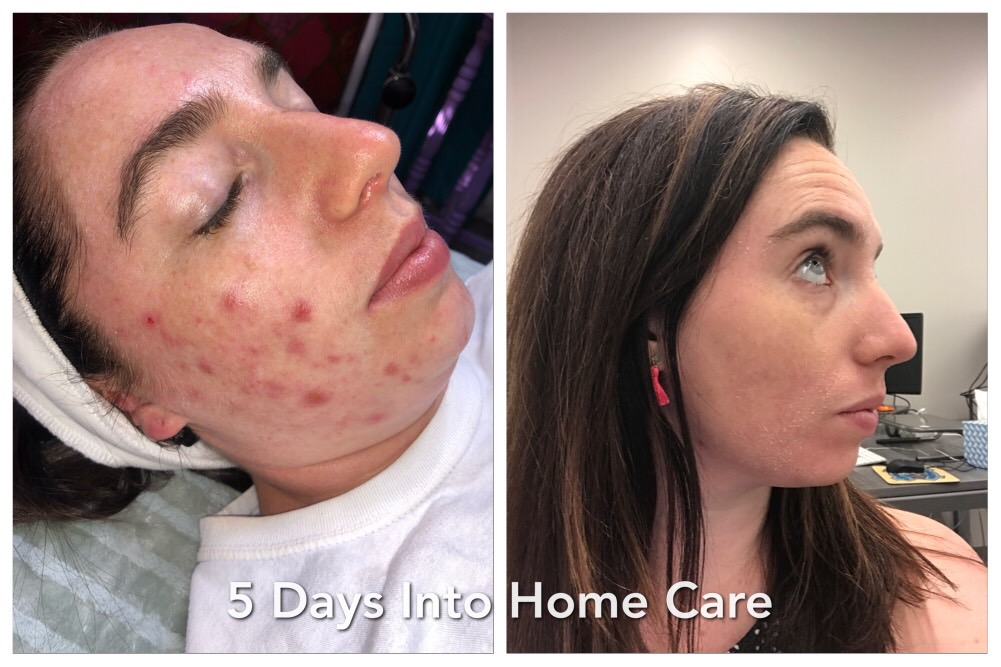 Skin Care Transformations